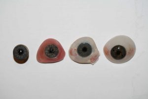 Prosthetic Eyes Specialists | Custom-Made Prosthetic Eyes NZ